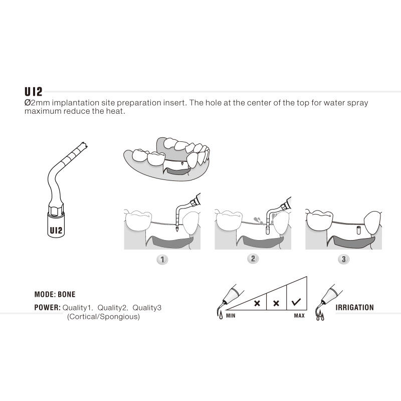 Insert Woodpecker & DTE