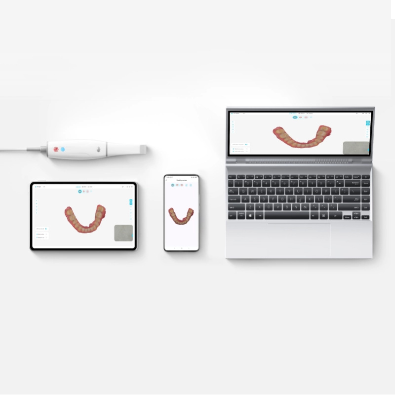 KEVIN PETER by Woodpecker - Scanner intra-oral Smile Scan