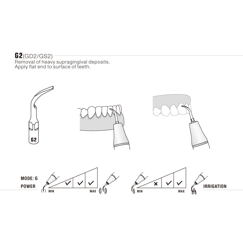 Insert dentaire Woodpecker DTE - GS2 - Wamkey.com