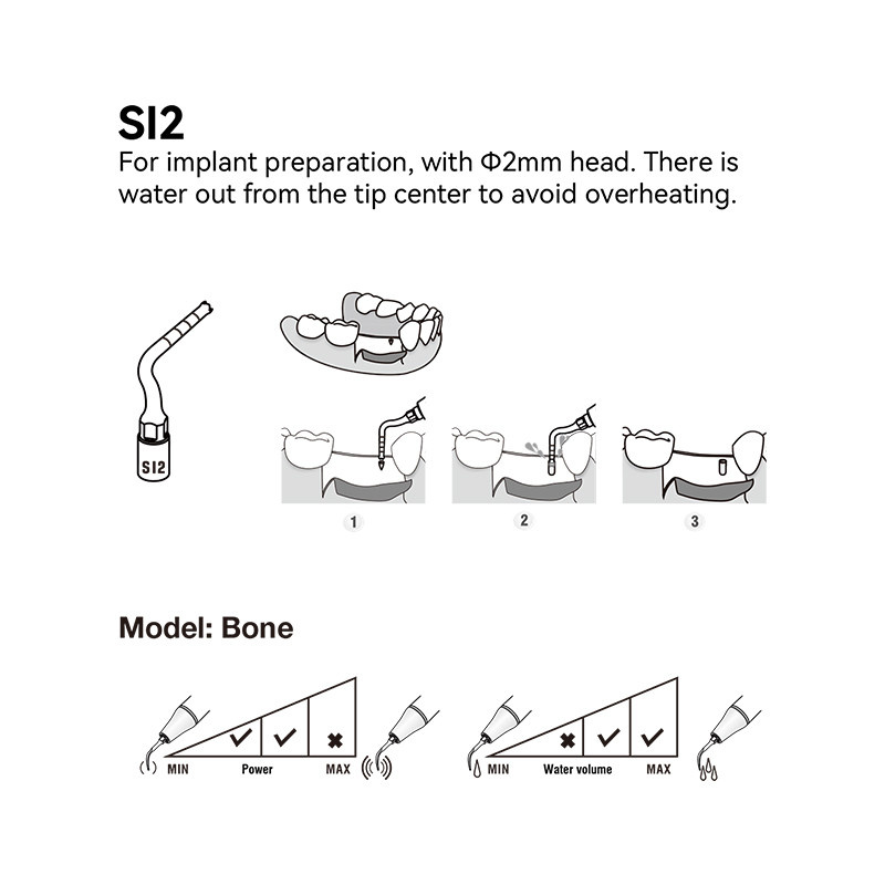 Insert dentaire WOODPECKER DTE - SI2 implant - wamkey.com