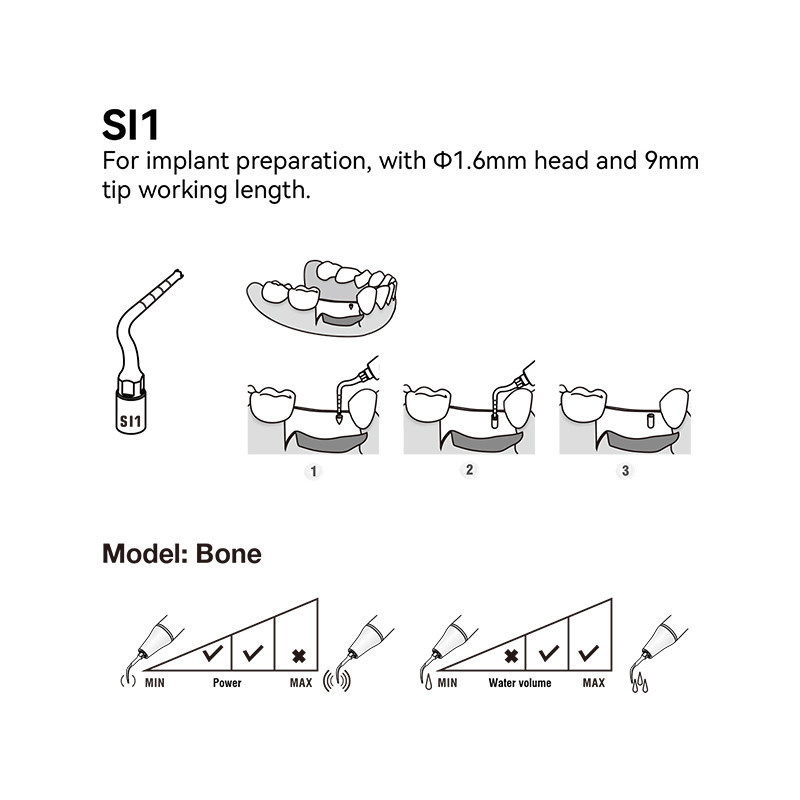 Insert dentaire WOODPECKER DTE - SI1 implant - wamkey.com