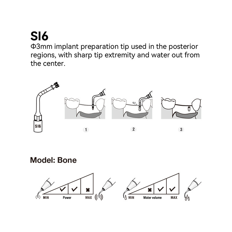 Insert WOODPECKER DTE - SI6