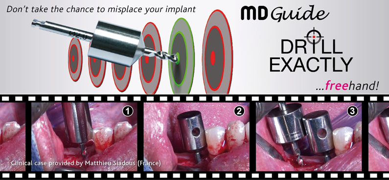 WAM MD Guide - surgical box